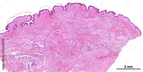 Human Breast Nipple Stock Illustration Adobe Stock