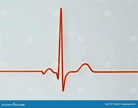 A Normal Electrocardiogram 3d Illustration Displaying The Electrical Activity Of The Heart In A