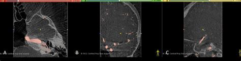 Dicom Images From Das In The 3d Slicer® Software A Axial B