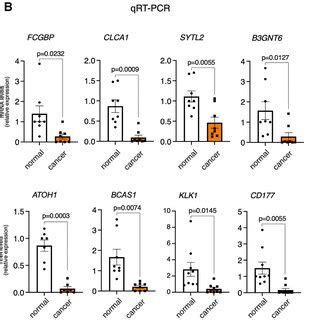 EPR And Select Target Genes Are Down Regulated In Human Cancers The Download Scientific