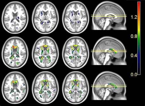 Voxel Based Analysis Of Mo Slices Positioned At Z 18 10 8 P Download Scientific Diagram