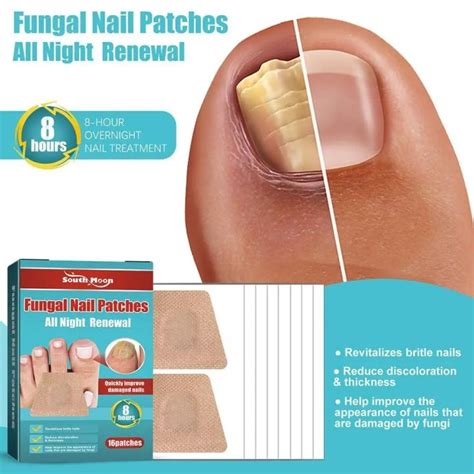 16pcs Nail Treatment Patch Anti Fungal Nail Correction Stickers Ingrown
