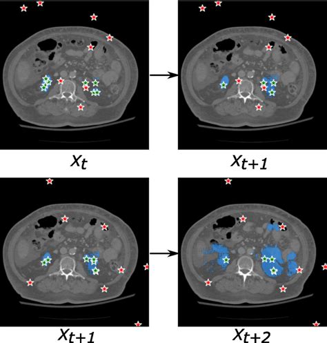An Example Of The Prompt Propagation Strategys Tendency Of Download Scientific Diagram