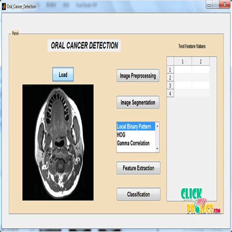 Comparison Of Feature Extraction Techniques To Classify Oral Cancers