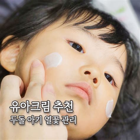유아크림 추천 두돌 아기 열꽃 관리 네이버 블로그