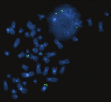 Metaphase Spread And A Interphase Cell Hybridized With The Dual Color