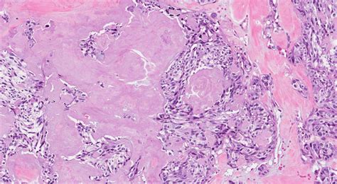 Амилоид Mypathologyreport
