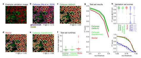 Transformers Do Not Outperform Cellpose Carsen Stringer And Marius… Volodymyr Nechyporuk Zloy