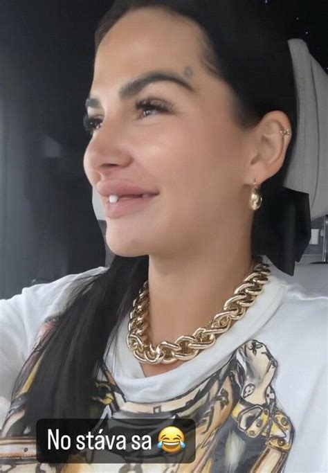 Galerie Queen Plačková Vyděsila Fanoušky úsměvem Vypadly Jí Zuby Foto 1 Bleskcz