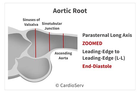 Back To The Basics Aortic Valve Anatomy Artofit