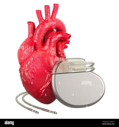 Human Heart With Implantable Cardiac Device 3d Rendering Isolated On White Background Stock
