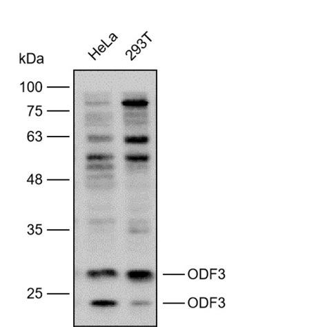 Solarbio K112214p Anti Odf3 Polyclonal Antibody 试剂仪器耗材