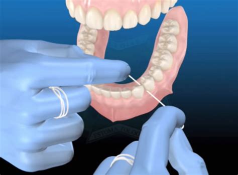 Reliable Steps On How To Use Dental Floss Properly