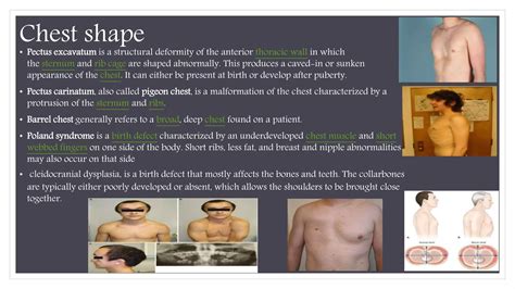 Chest And Lung Examination Pptx