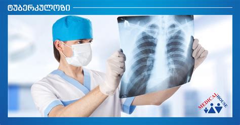 ტუბერკულოზი