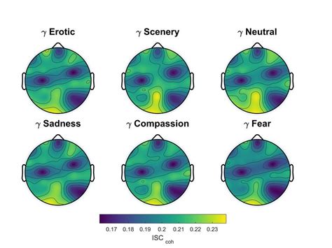 Scalp Map Showing The Topographical Distribution Of The Inter Subject Download Scientific