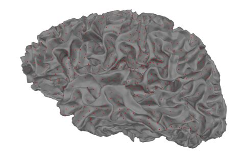 The Role Of Dipole Orientations In Distributed Source Localization
