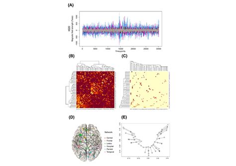 Minimum Spanning Tree Analysis For Epilepsy Magnetoencephalography Meg