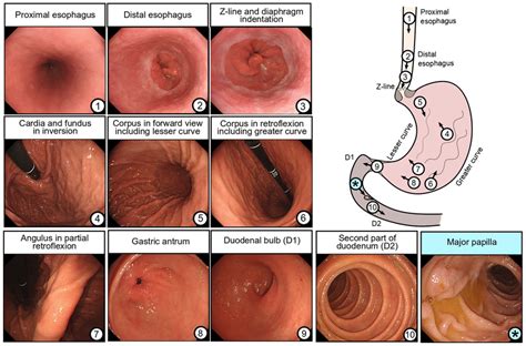 Photo Documentation D1 Duodenal Bulb D2 Second Part Of Duodenum Download Scientific Diagram
