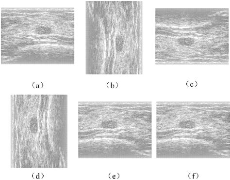 Figure 1 From Semantic Segmentation With Densenets For Breast Tumor