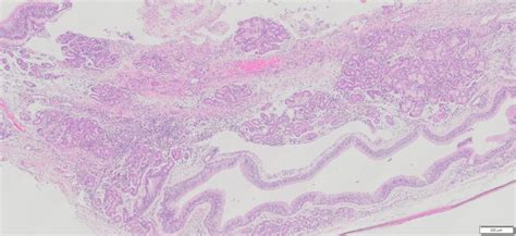 Human Sinus Normal Ffpe Sections