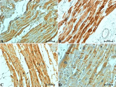 Sex Differences In Distribution Of Cannabinoid Receptors Cb1 And Cb2