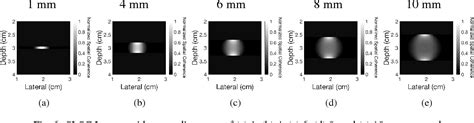 Figure 6 From Additive Noise Models For Photoacoustic Spatial Coherence Theory Semantic Scholar