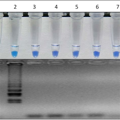 Sensitivity Of Lamp Vs Conventional Pcr Detection By A Lamp And Hnb