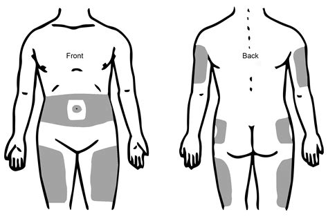 Insulin Injection Sites Diagram Diabetes Injection Sites Complete