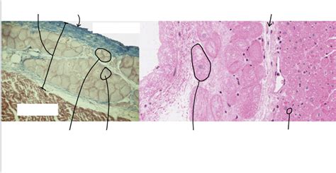 Purkinje Fibers Diagram Quizlet