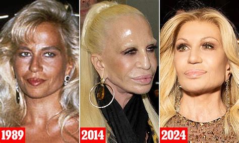 What Has Donatella Versace Done To Her Face Now A Look Back At Her