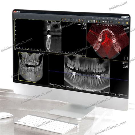 Dental Imaging Software Gold Health Tech