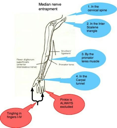 16 Best Images About Nerve Compression On Pinterest Ulnar Nerve