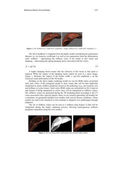 Liver Pathology Simulation Algorithm For Haptic Rendering And Force