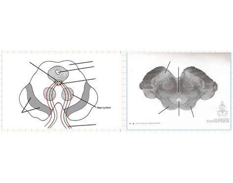 Cross Section Of The Midbrain Quiz