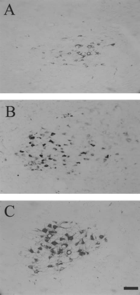 Staining Of Midbrain After Hrp Retrograde Tracing Of Rsn 8 Weeks After