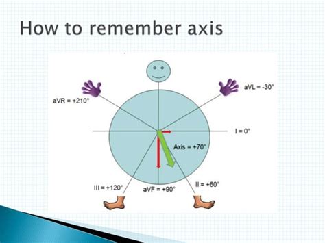 ECG Indication And Interpretation PPTX