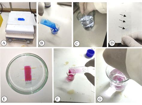 Double Staining Method A Technique To Visualize Plant Fungus Interactions Using Ruthenium Red