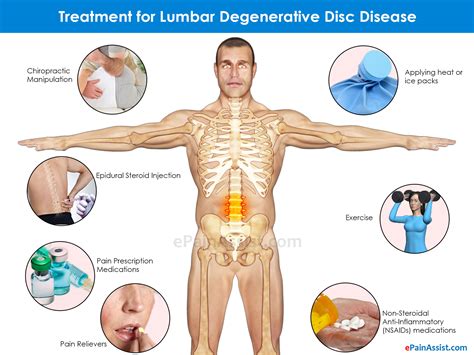 Types Of Degenerative Disc Disease And Its Symptoms Treatment