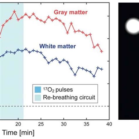 4 Illustration Of The 2d Cartesian Sampling Scheme Left And 2d