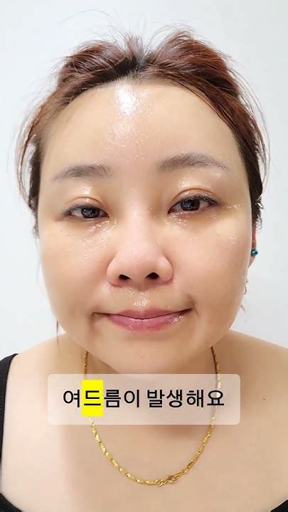 피부는 열 받으면 안된다 왜 엄첨난 문제가 생겨 댓글을 꼭 읽으세요 꿀피부만들기 여드름 Skincare 노화방지 그린박신 겔스타터 Youtube