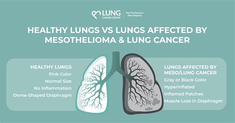 How To Improve Lungs Health After Cancer Diagnosis