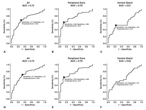 Receiver Operating Characteristic Roc Curves Of Detecting Tumor