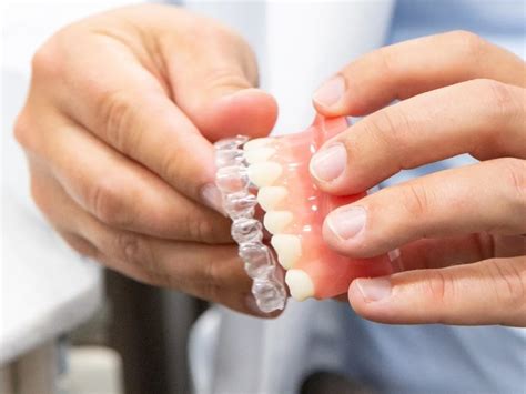 1 Simple Timeline For How Long Does Invisalign Take How Quickly Can You Achieve Your Ideal Smile