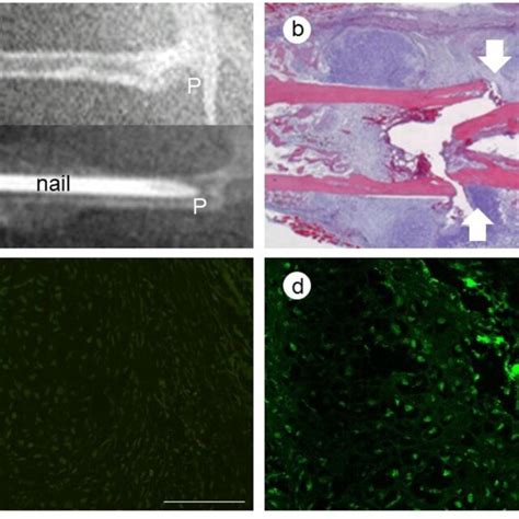 Overview Of The Creation Of The Bone Fracture Model Bone Radiological Download Scientific