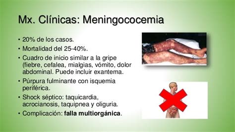 Enfermedad Meningocócica