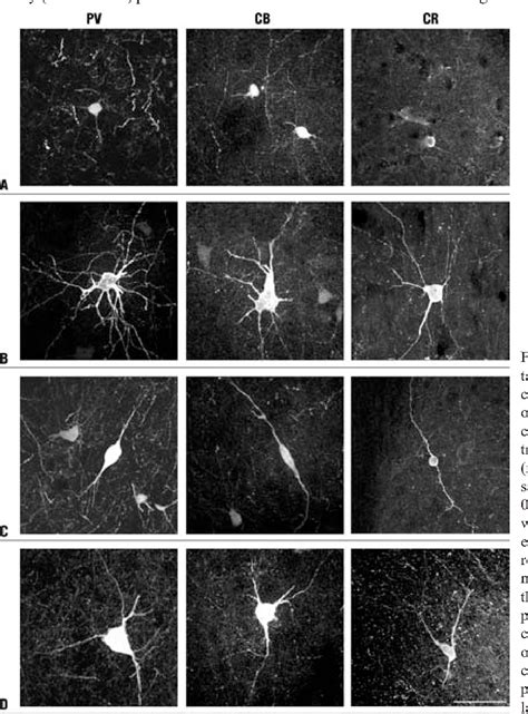 Figure 1 From Analysis Of Calcium Binding Protein Immunoreactivity In