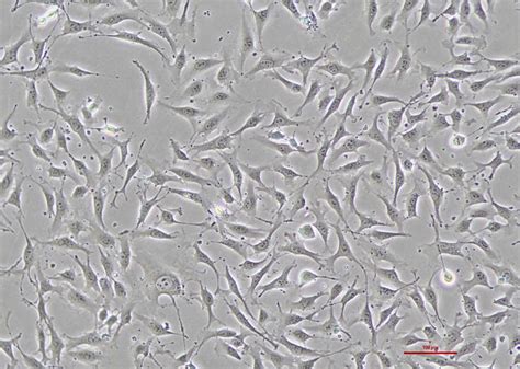 人脐静脉细胞融合细胞 Eahy926（str鉴定正确）细胞系细胞库旗赛生物科技（武汉）有限公司