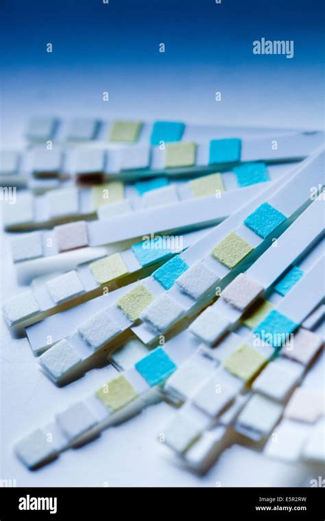 Multiple Urine Test Strips For Urinary Tract Infection Uti Screening Stock Photo Alamy