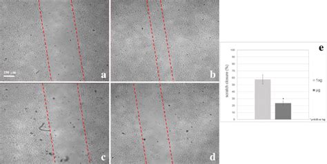 scratch assay—by using the scratch assay migration of individual